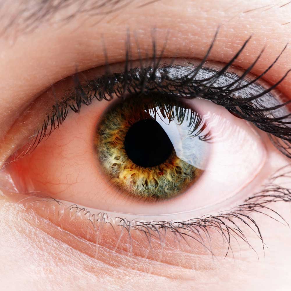 B.A.C. EYE CARE – PIONEER IN VISION CARE